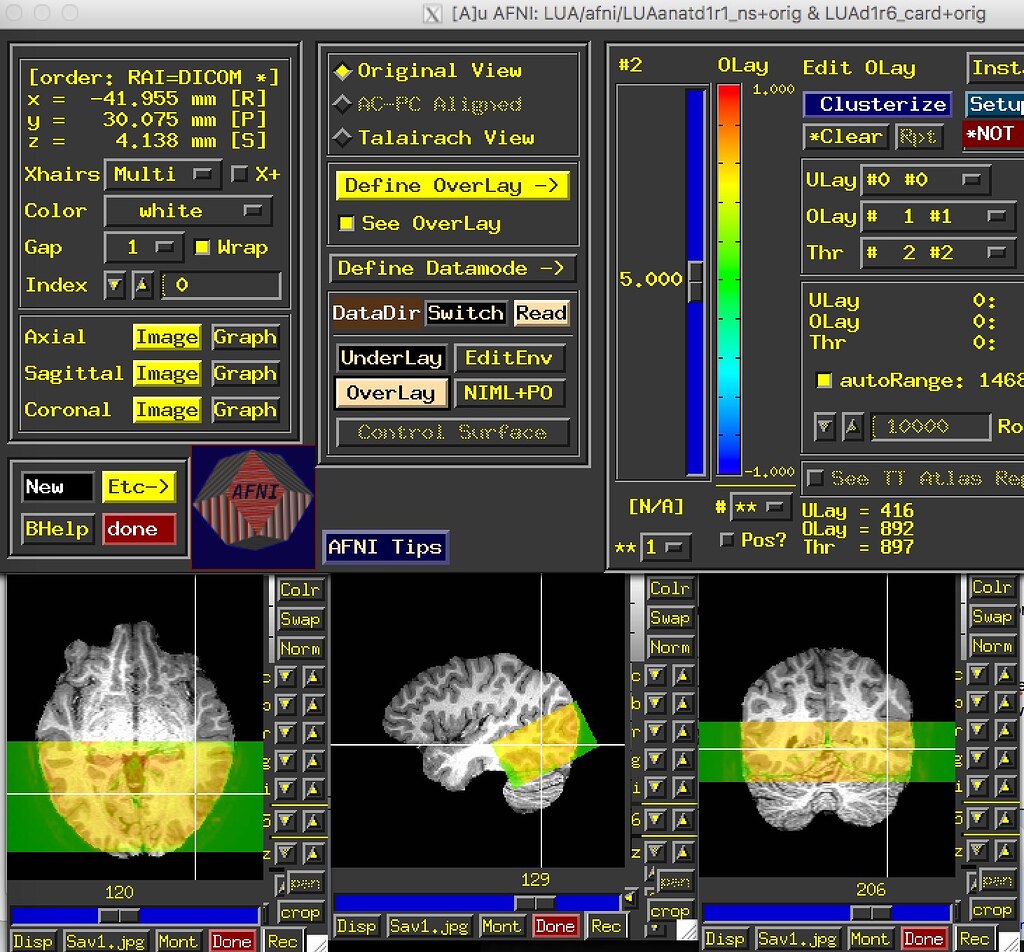 ZOOMit partial volume alignment challenge - AFNI Message Board - AFNI ...