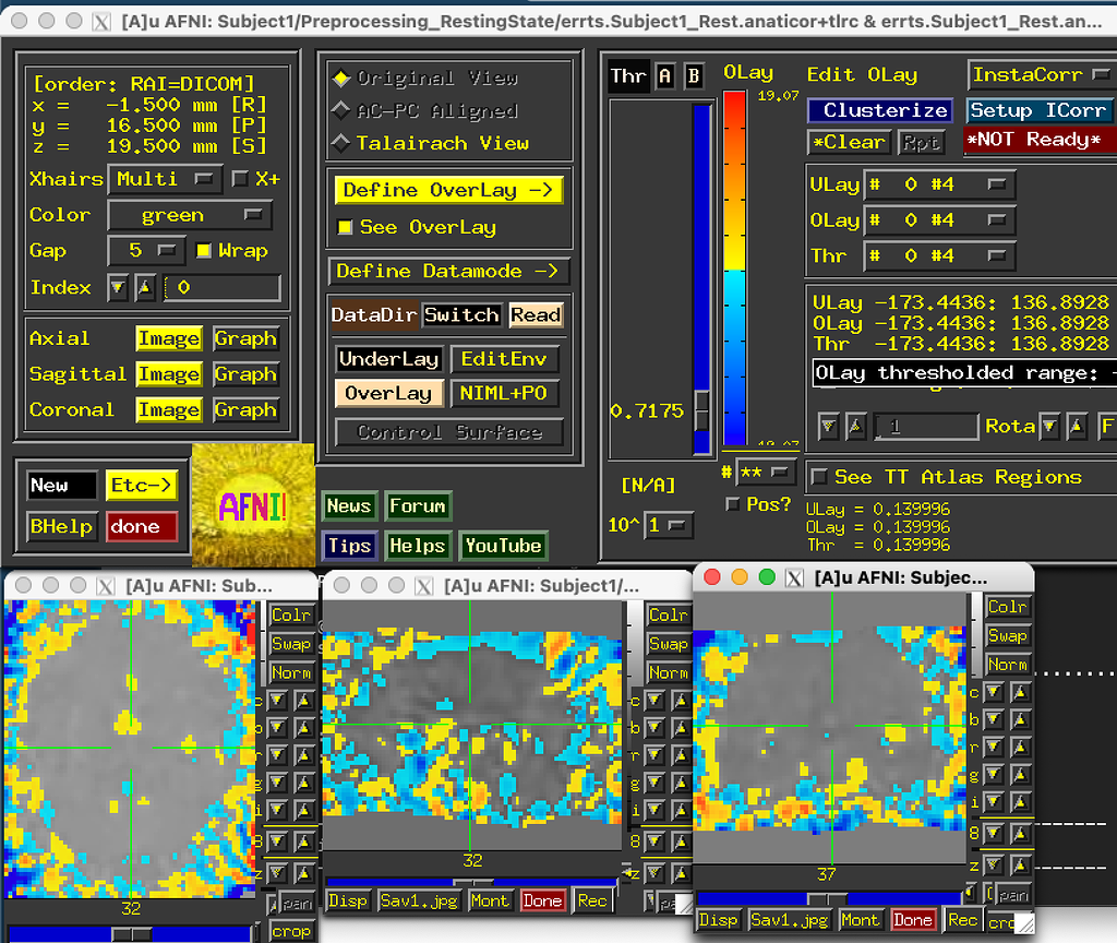 AFNI_proc.py: Resting-State Analysis: .errts. defective result - AFNI ...