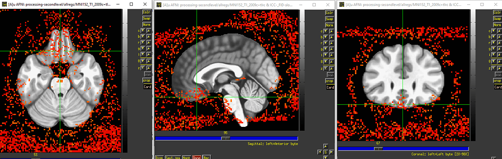 3D ICC, a lot of outside brain sig voxels - AFNI Message Board - AFNI ...