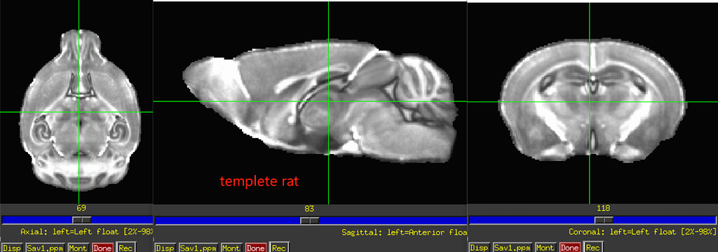 How To Rotate Mouse Brain Mri For Quick Afni Registration Afni Message Board Afni Discuss