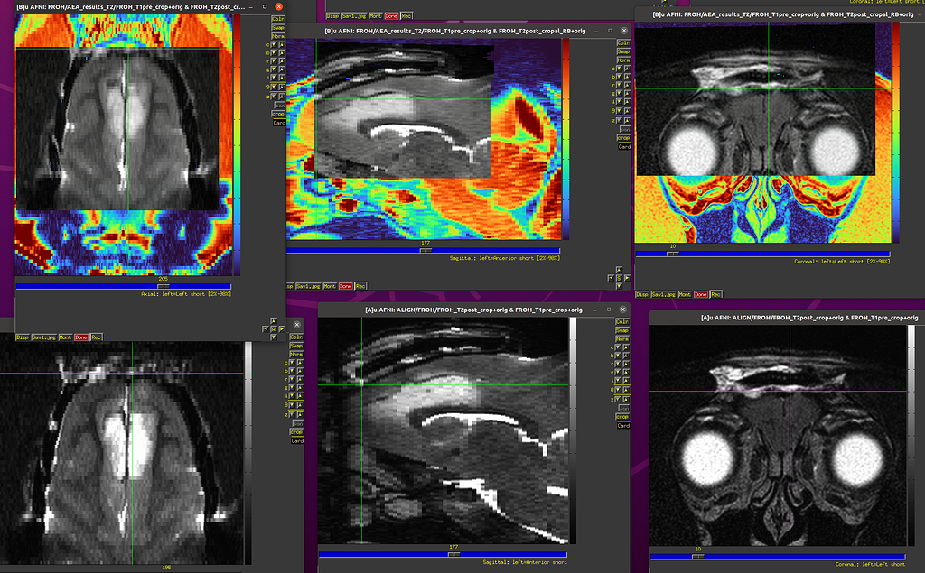 Align Epi Anat Cropping Afni Message Board Afni Discuss Message Board