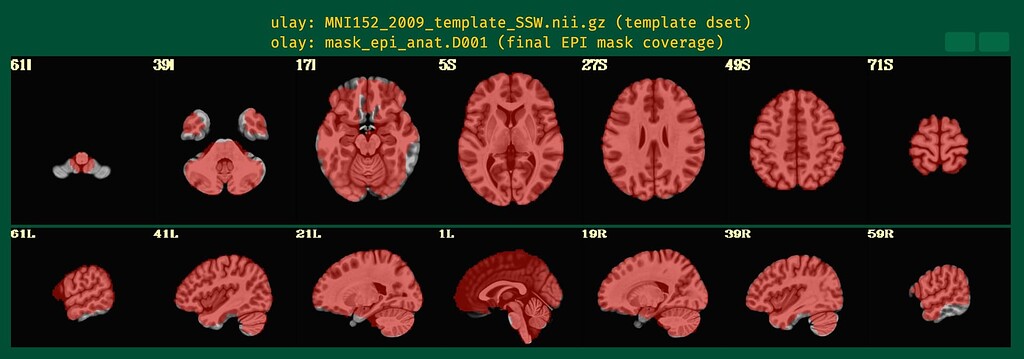 Epi Mask Misalignment After Sswarper2 And Afni Proc Py Afni Message Board Afni Discuss