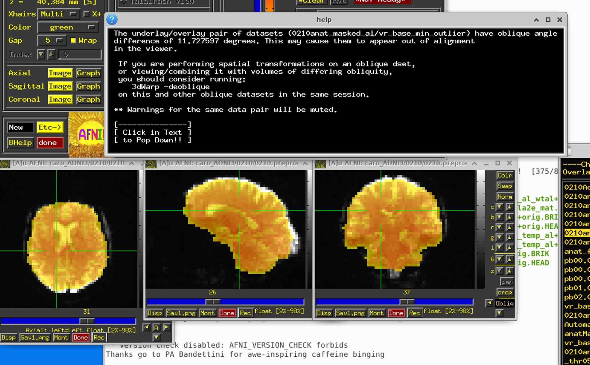 how to add -cmass to align_epi_anat.py - AFNI Message Board - AFNI ...